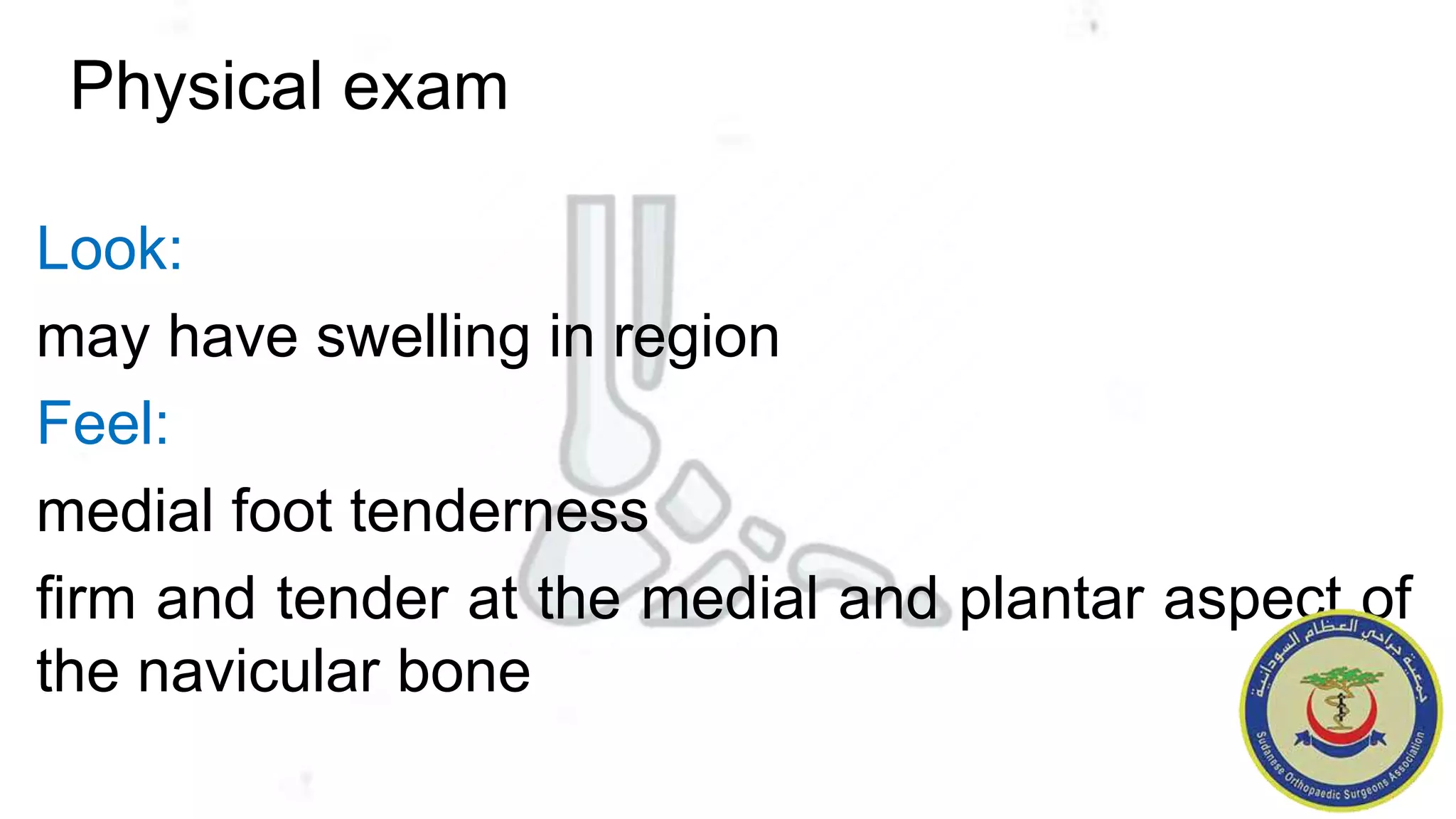 painfull accessory navicular bone(1).pptx