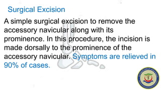 painfull accessory navicular bone(1).pptx