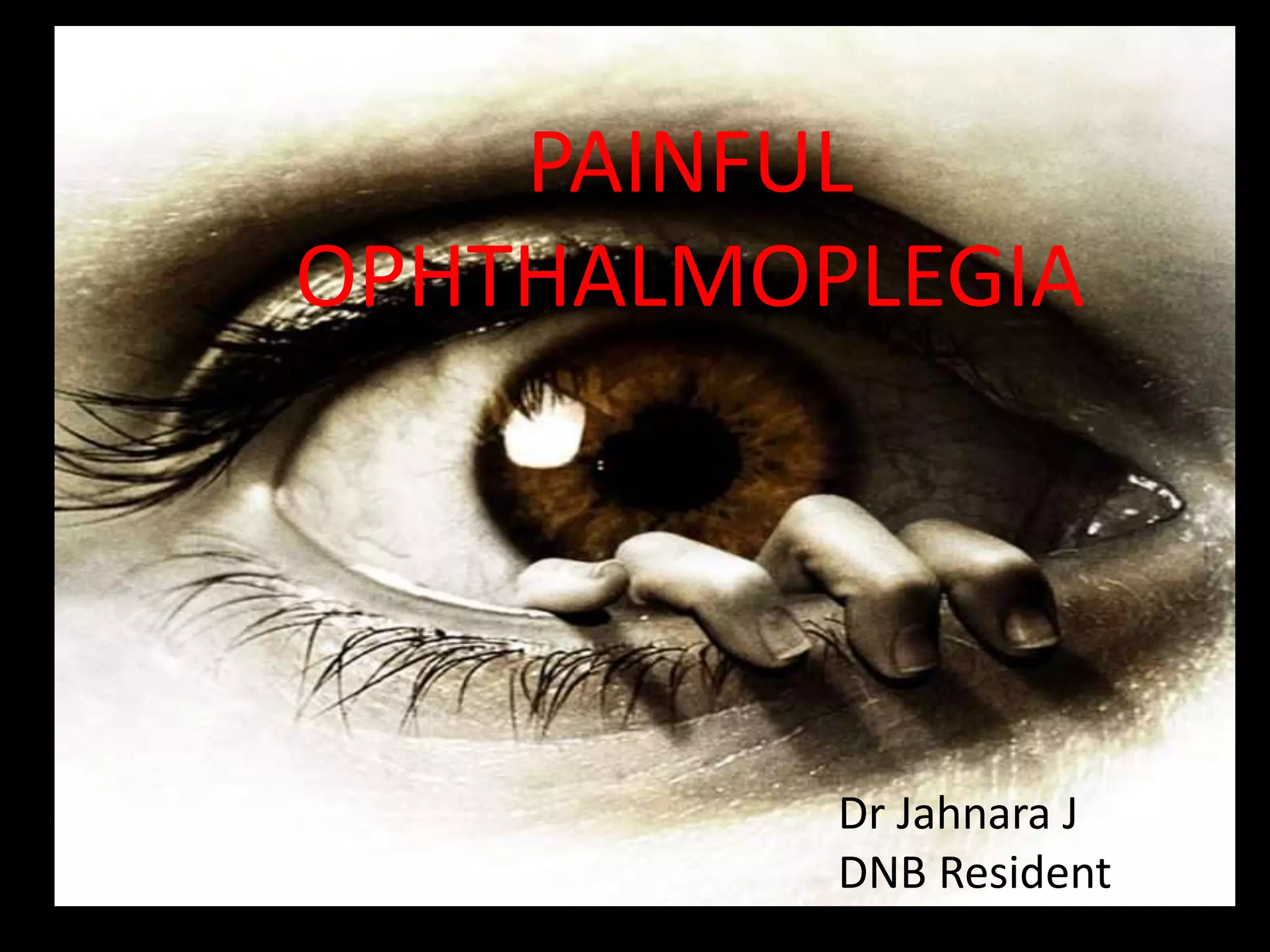 Painful Ophthalmoplegia | PPT