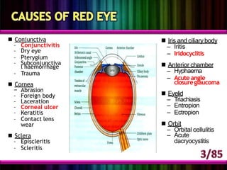 Painful Red Eye Management (1).pptx