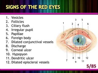 Painful Red Eye Management (1).pptx