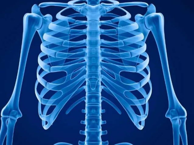 Painful rib syndrome latest | PPT