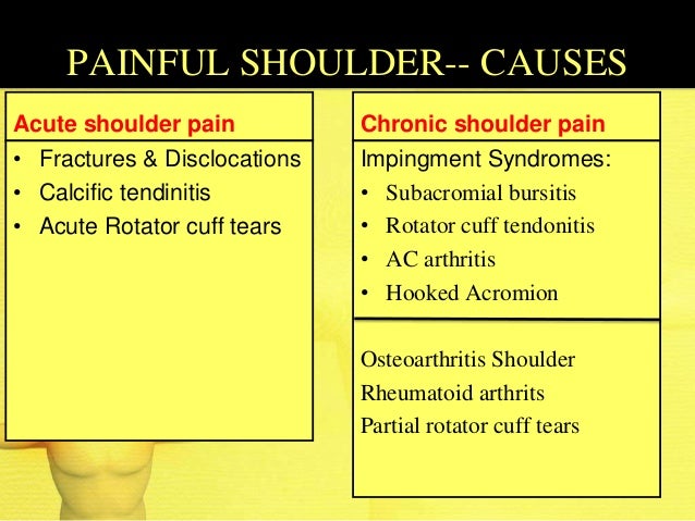 Shoulder Pain Diagnosis Chart