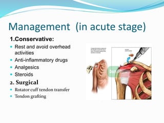 Painful shoulder arc | PPTX