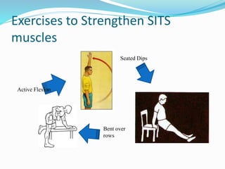 Painful shoulder arc | PPTX