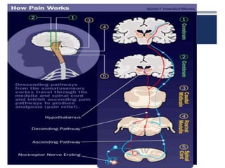 Pain gate theory | PPTX