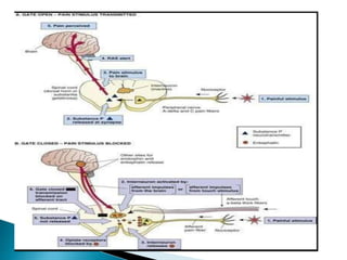 Pain Gate theory.pptx