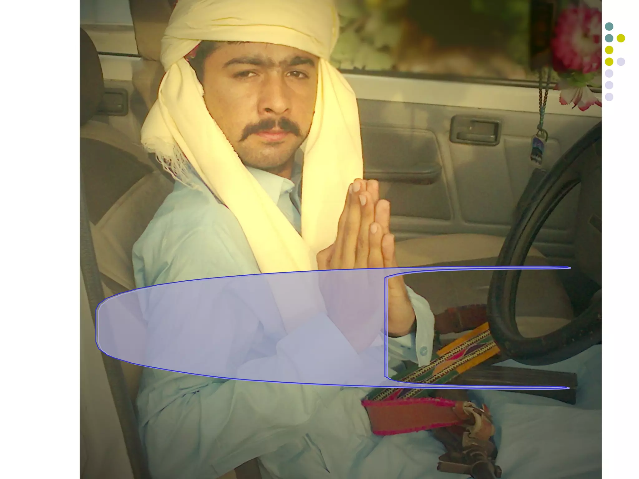 Pain gate theory | PPT