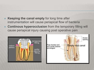 Pain in endodontics | PPTX