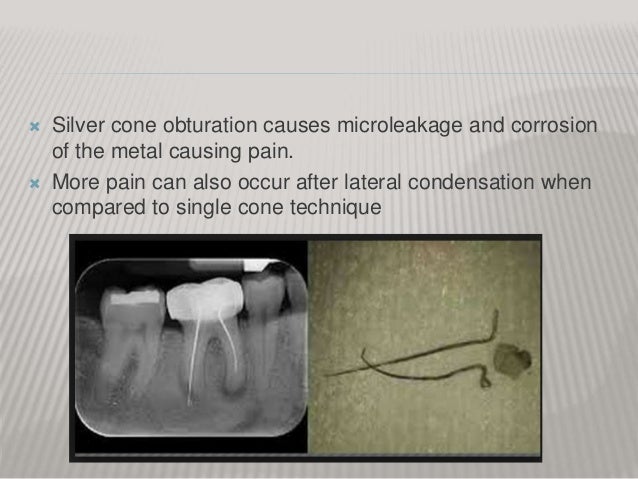 Pain in endodontics