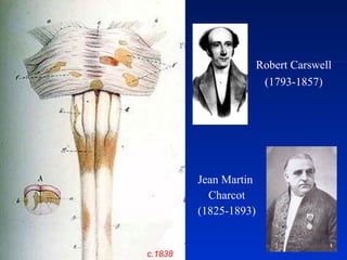 Pain in MS | PPT