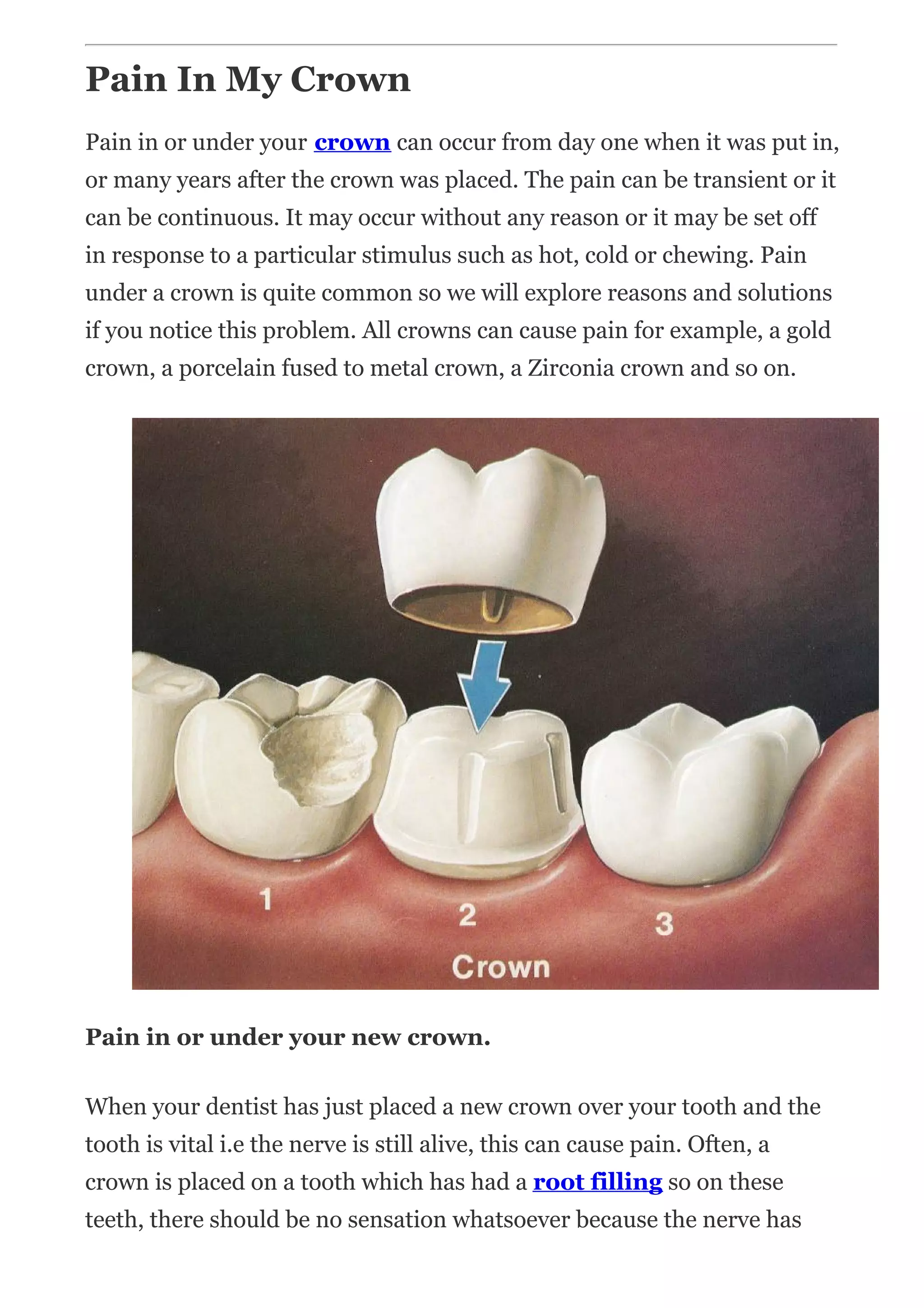 Pain In My Crown - Dr Muzzafar Zaman | PDF