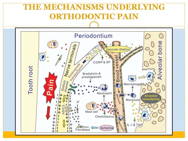PAIN IN ORTHODONTICS seminar 10.pptx