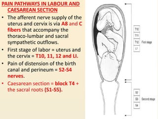 Painless labor | PPTX