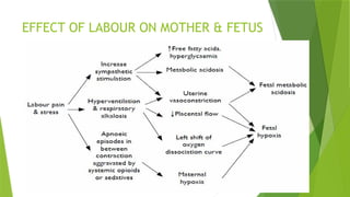 PAINLESS LABOUR- EPIDURAL ANALGESIA-.pptx