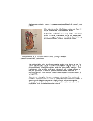 Painless lip filling | PDF