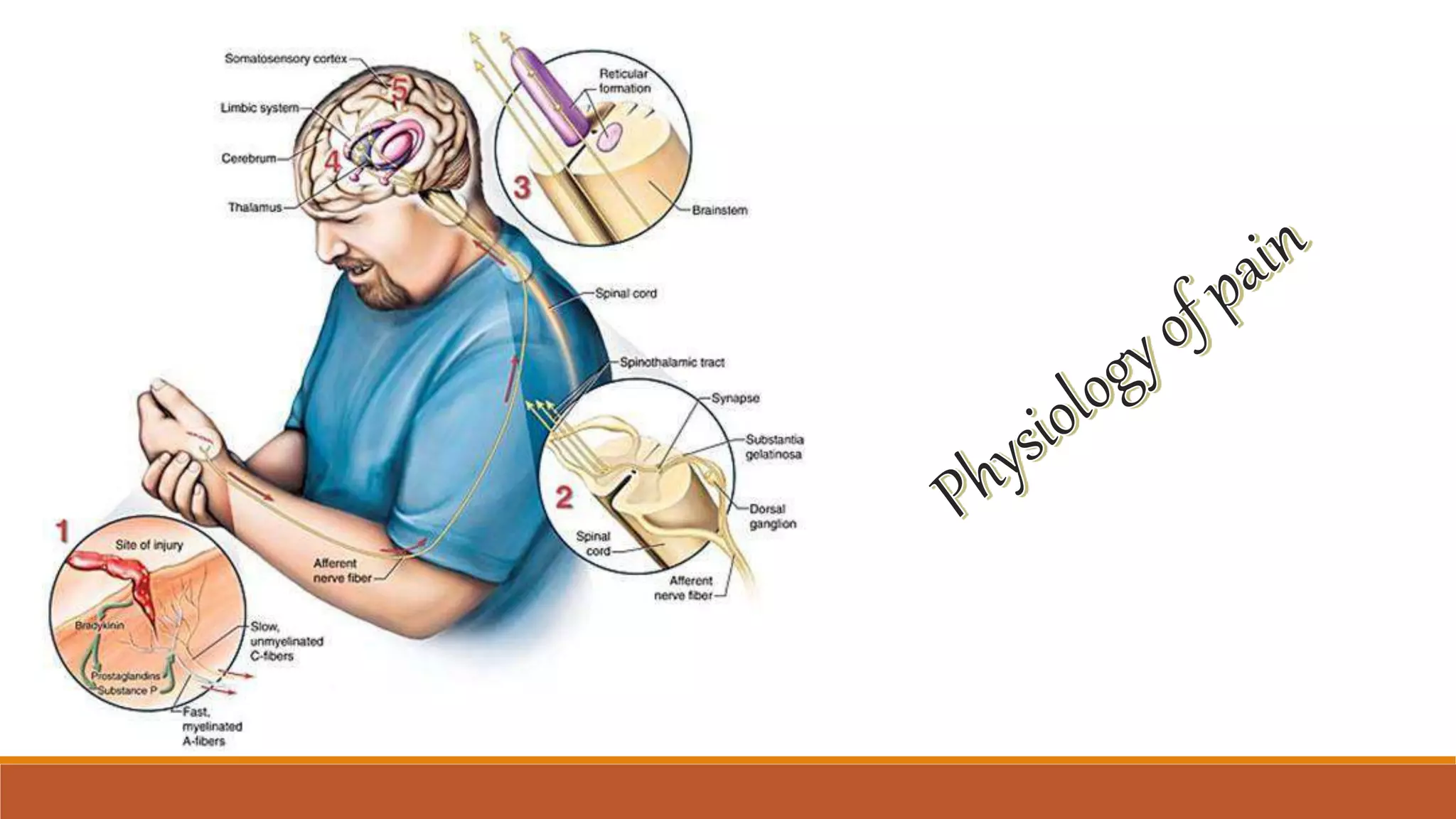 pain_management.ppt