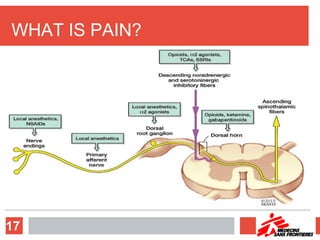 Pain management | PPTX