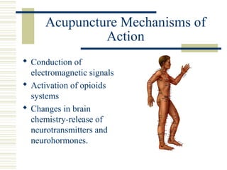 Pain management by acupuncture | PPT