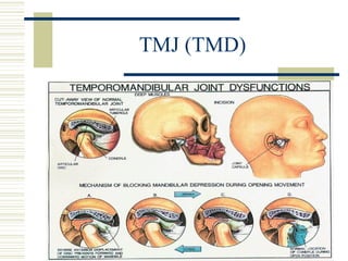 Pain management by acupuncture | PPT