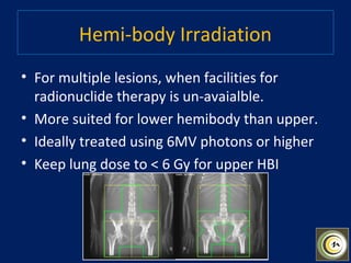 Pain management in cancer patients | PPT