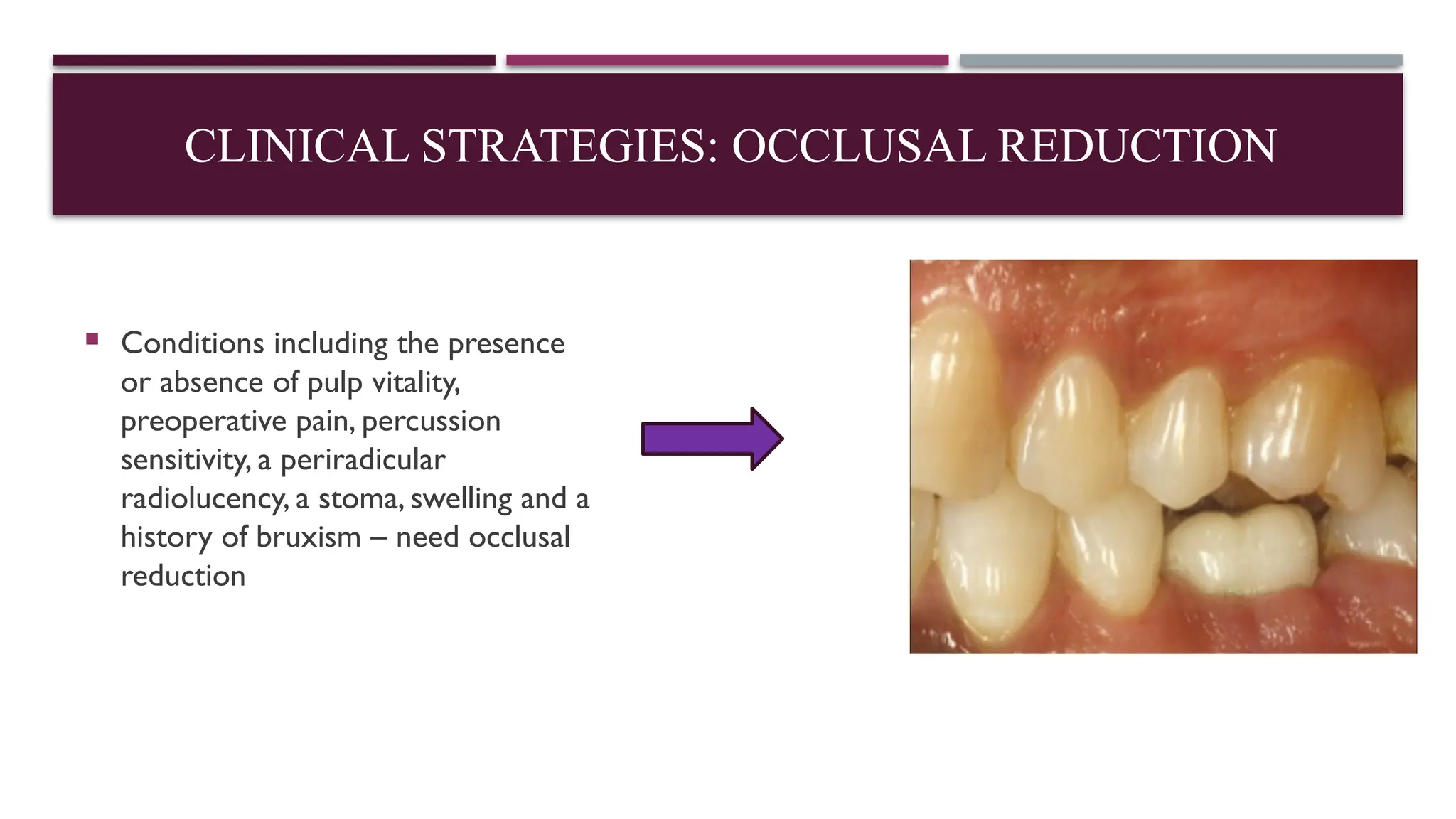 PAIN MANAGEMENT IN ENDODONTICS................pptx