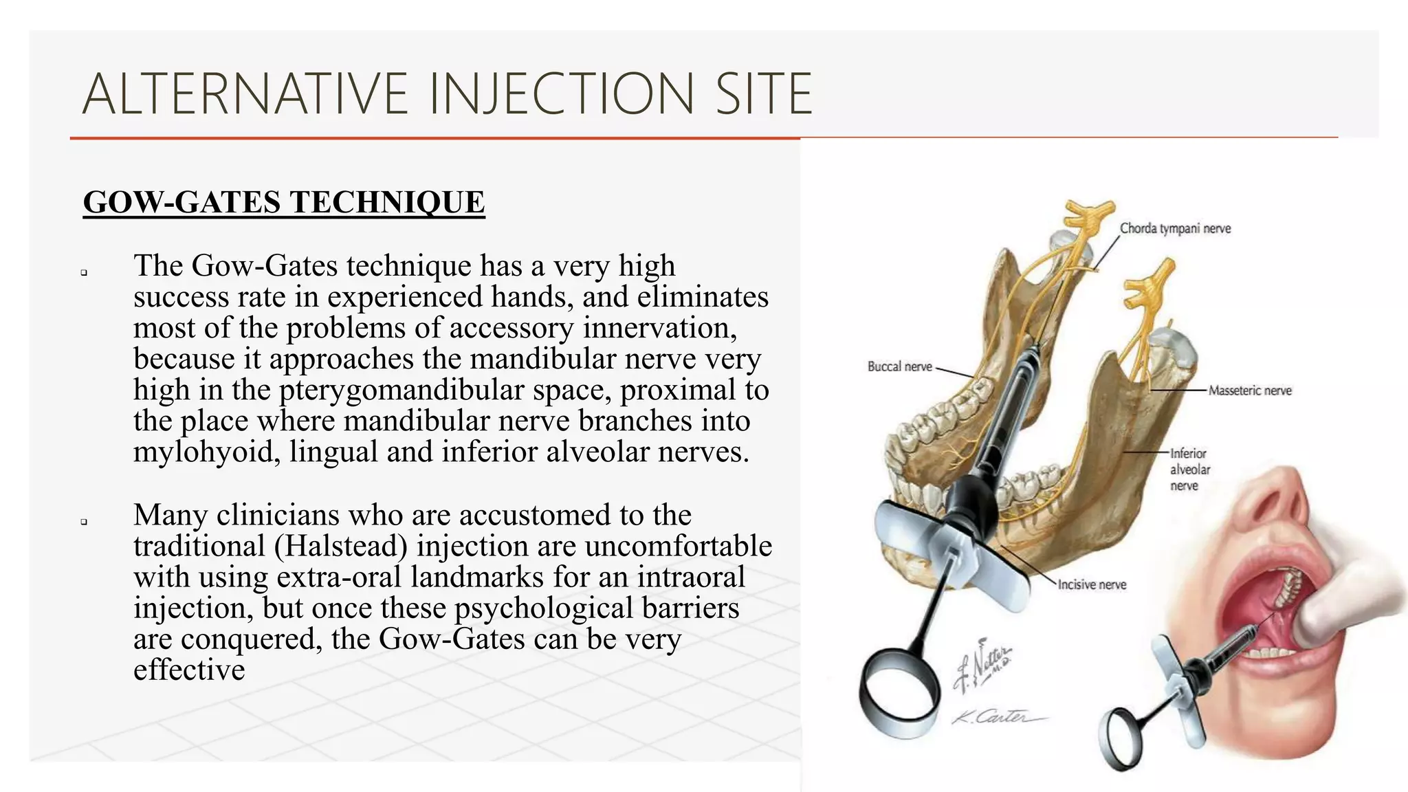 Pain management in Restorative dentistry and Endodontics - fathima ...