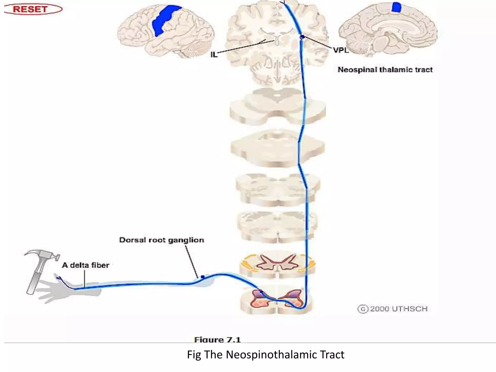 Pain pathway | PPTX