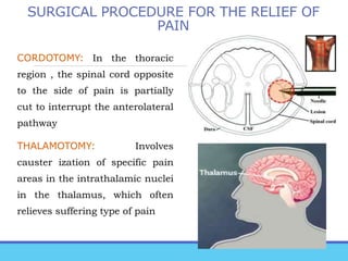 Pain pathways | PPTX