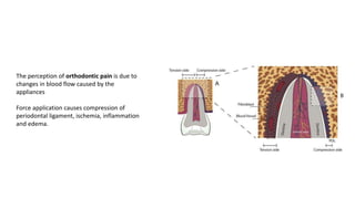 Pain Pathways In Orthodontics.pptx
