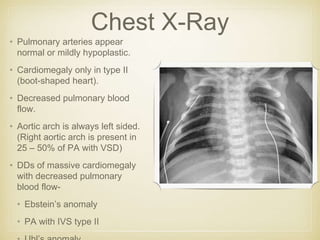 PA/IVS - Dr. Julius King Kwedhi | PPTX