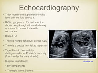 PA/IVS - Dr. Julius King Kwedhi | PPTX