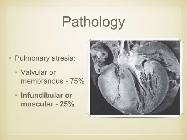 PA/IVS - Dr. Julius King Kwedhi | PPTX
