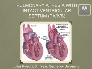PA/IVS - Dr. Julius King Kwedhi | PPT