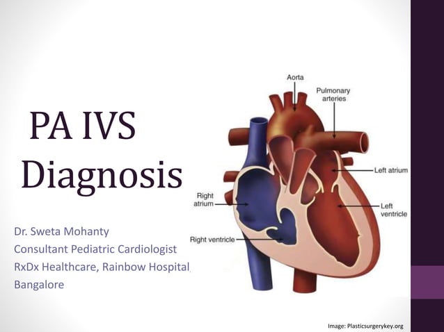 Pulmonary atresia with intact interventricular septum | PPT