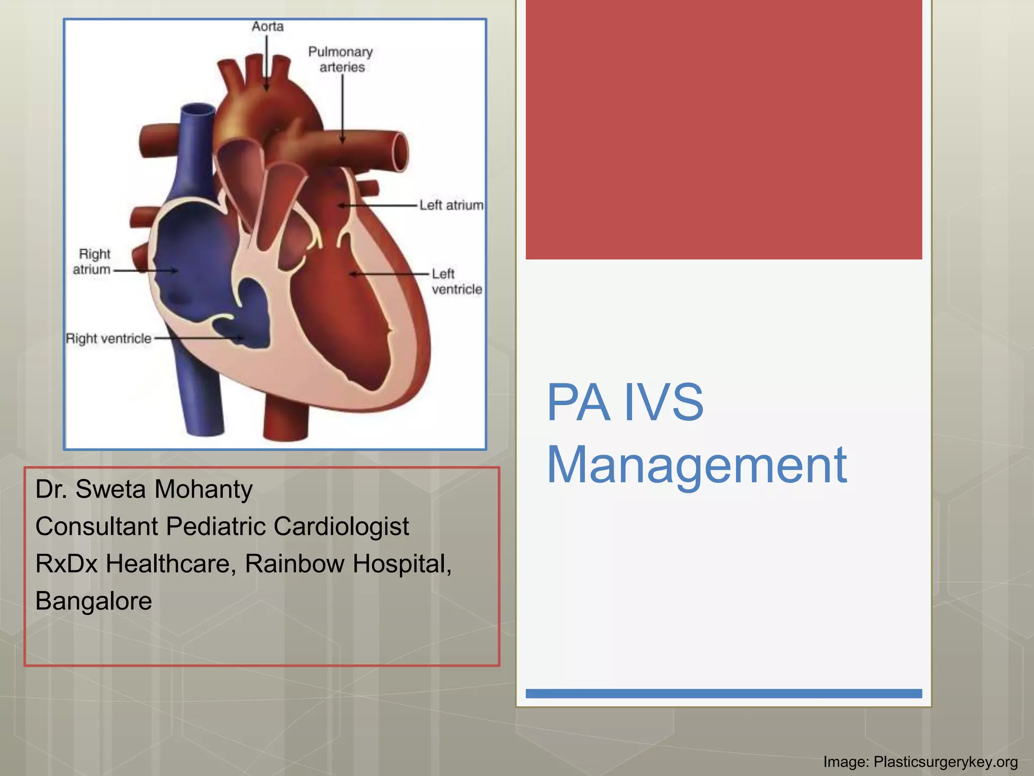 Pulmonary atresia with intact interventricular septum management | PPTX