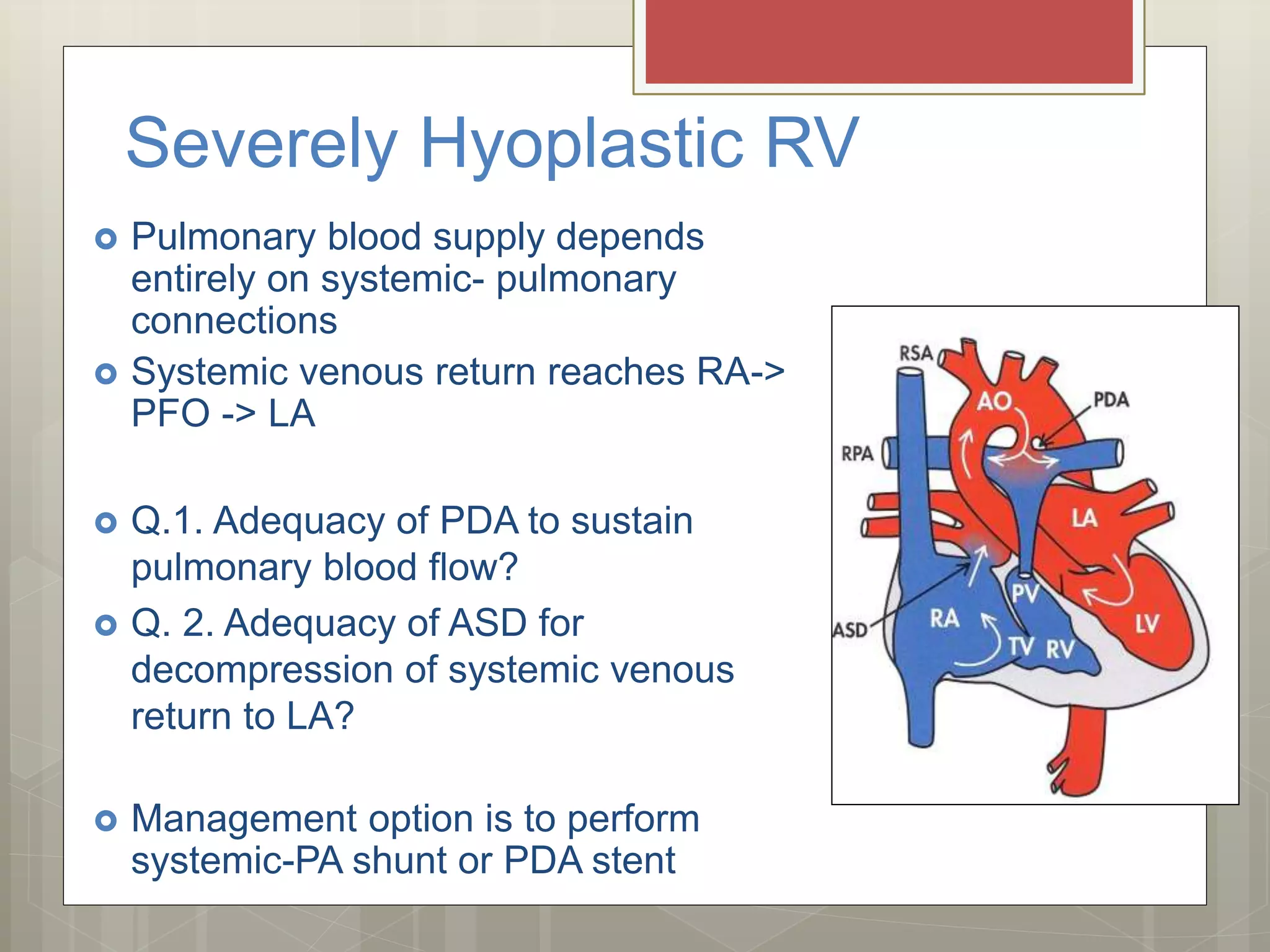 Pulmonary atresia with intact interventricular septum management | PPTX