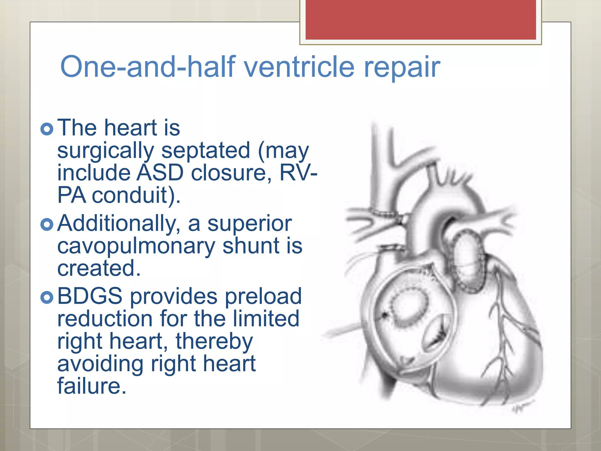Pulmonary atresia with intact interventricular septum management | PPTX