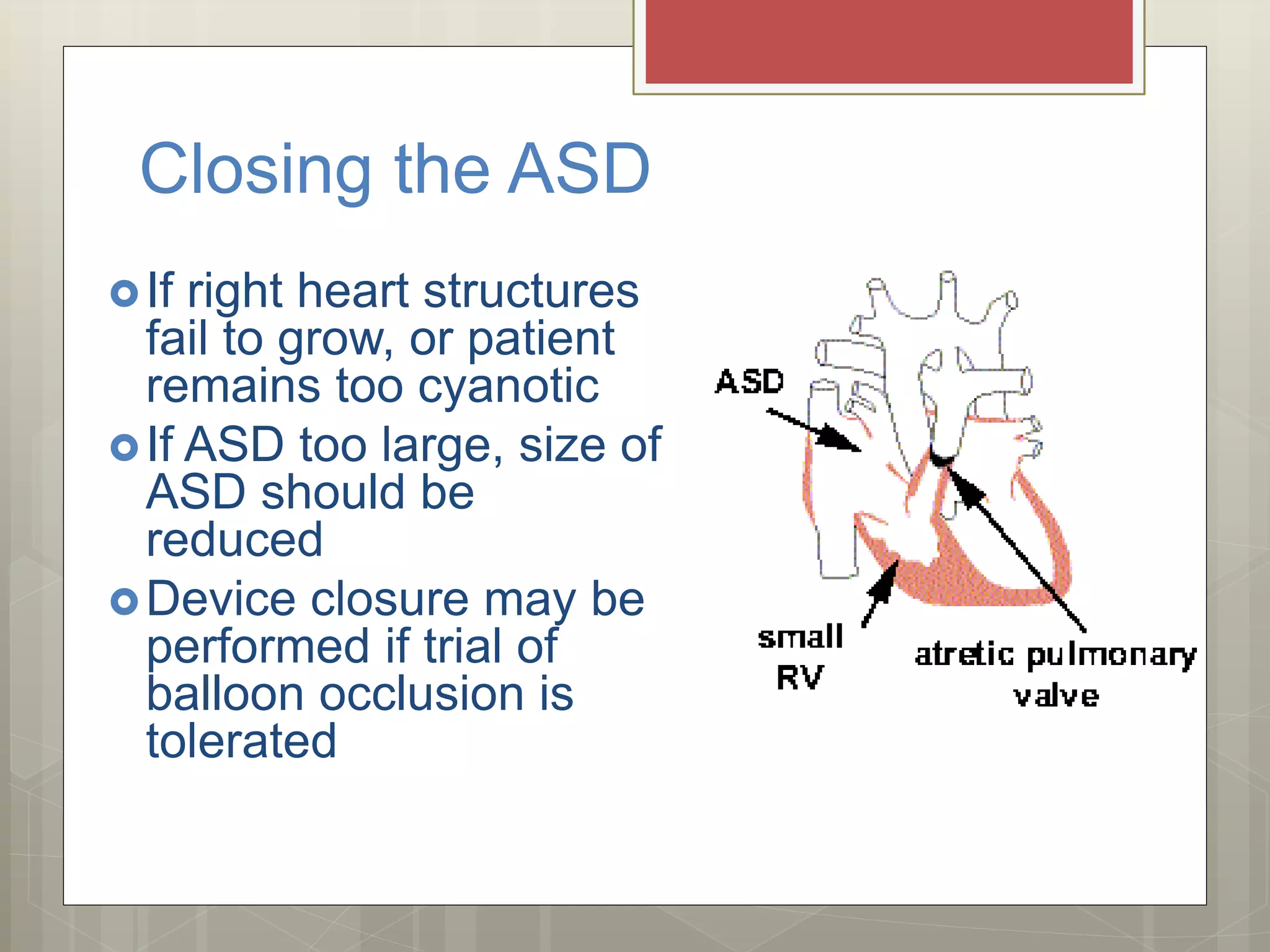 Pulmonary atresia with intact interventricular septum management | PPTX