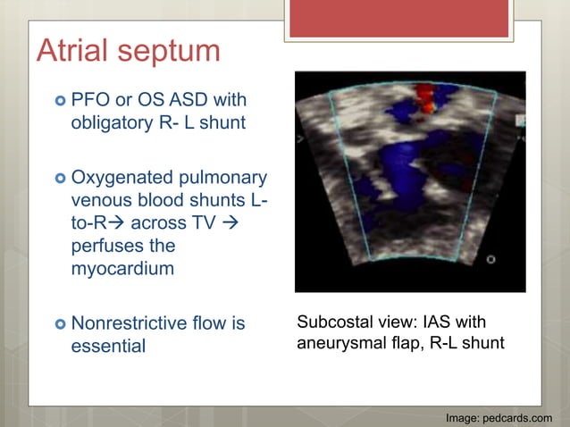 Pulmonary atresia with intact interventricular septum management | PPTX ...