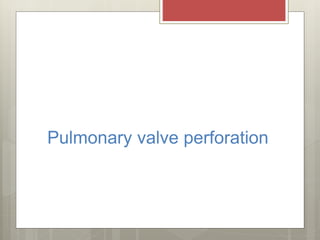 Pulmonary atresia with intact interventricular septum management | PPTX