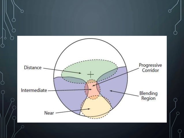 progressive addition lenses- optics, designs and performances | PPTX ...