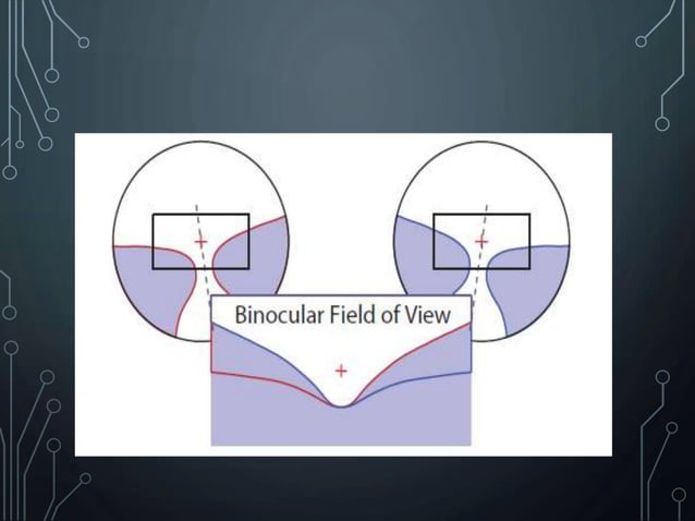 progressive addition lenses- optics, designs and performances | PPTX ...