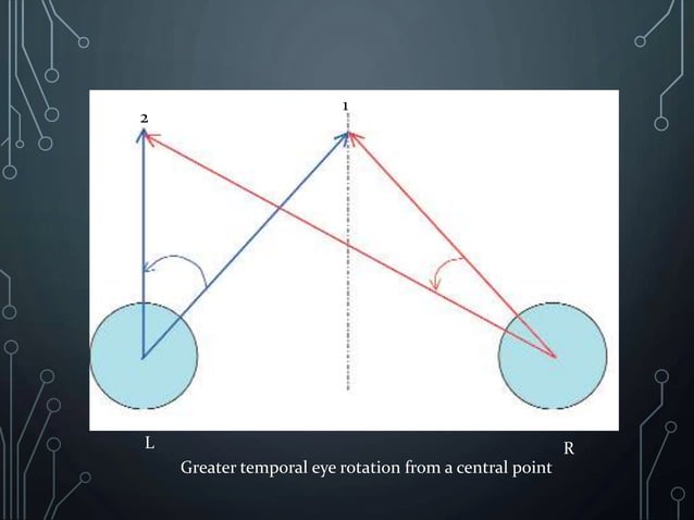 progressive addition lenses- optics, designs and performances | PPTX ...