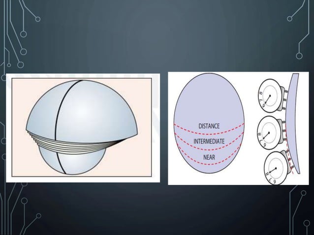 progressive addition lenses- optics, designs and performances | PPTX ...