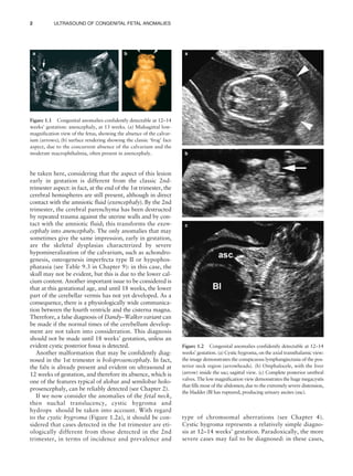Paladini Us Of Congenital Fetal Anomalies 1st Edition | PDF