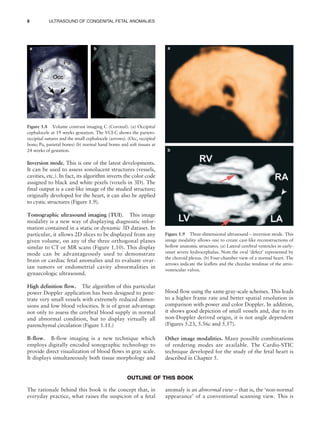 Paladini Us Of Congenital Fetal Anomalies 1st Edition | PDF