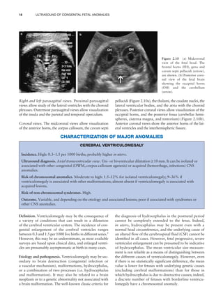 Paladini Us Of Congenital Fetal Anomalies 1st Edition | PDF