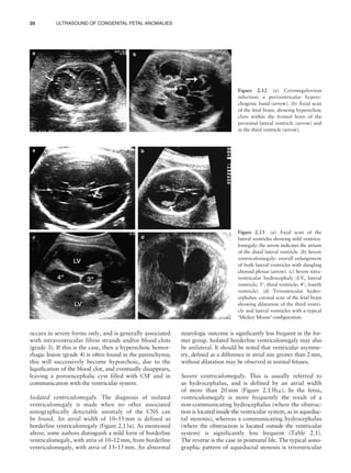 Paladini Us Of Congenital Fetal Anomalies 1st Edition | PDF