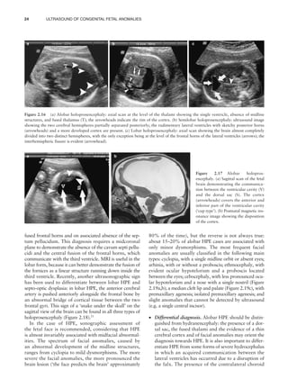 Paladini Us Of Congenital Fetal Anomalies 1st Edition | PDF